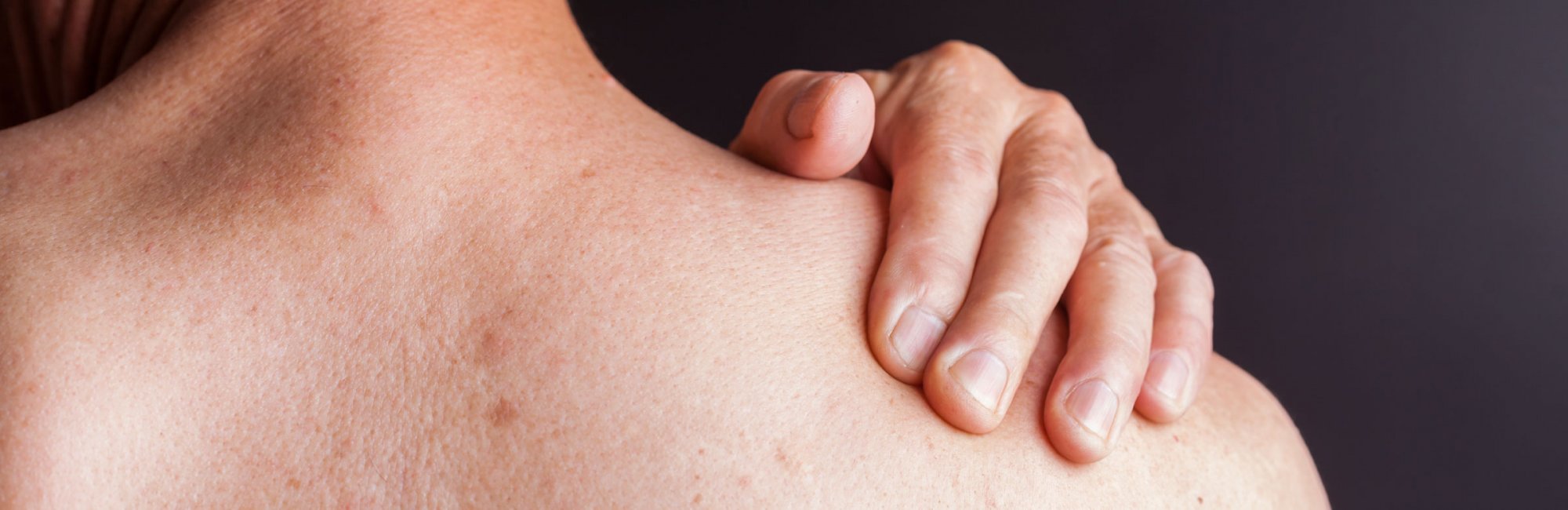 Shoulder Pain Newcastle | Blog | Poke Acupuncture